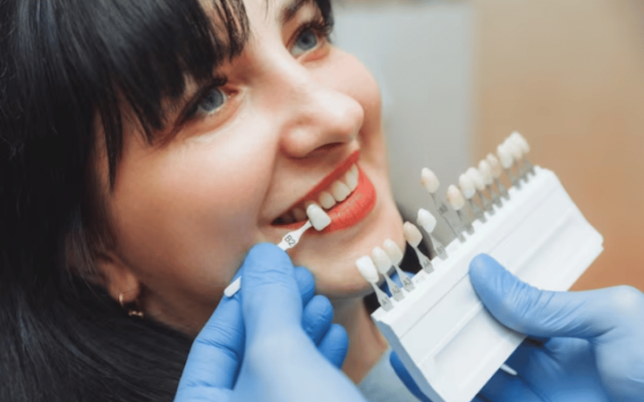 What Are Dental Laminates? - Lake Worth Dentistry